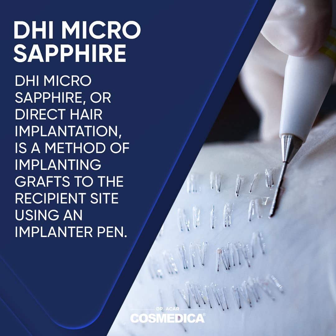 DHI Hair Transplant - Cosmedica Clinic Istanbul | Dr. Acar