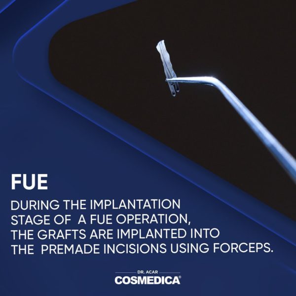 FUE hair transplant - Cosmedica Clinic | Dr. Levent Acar