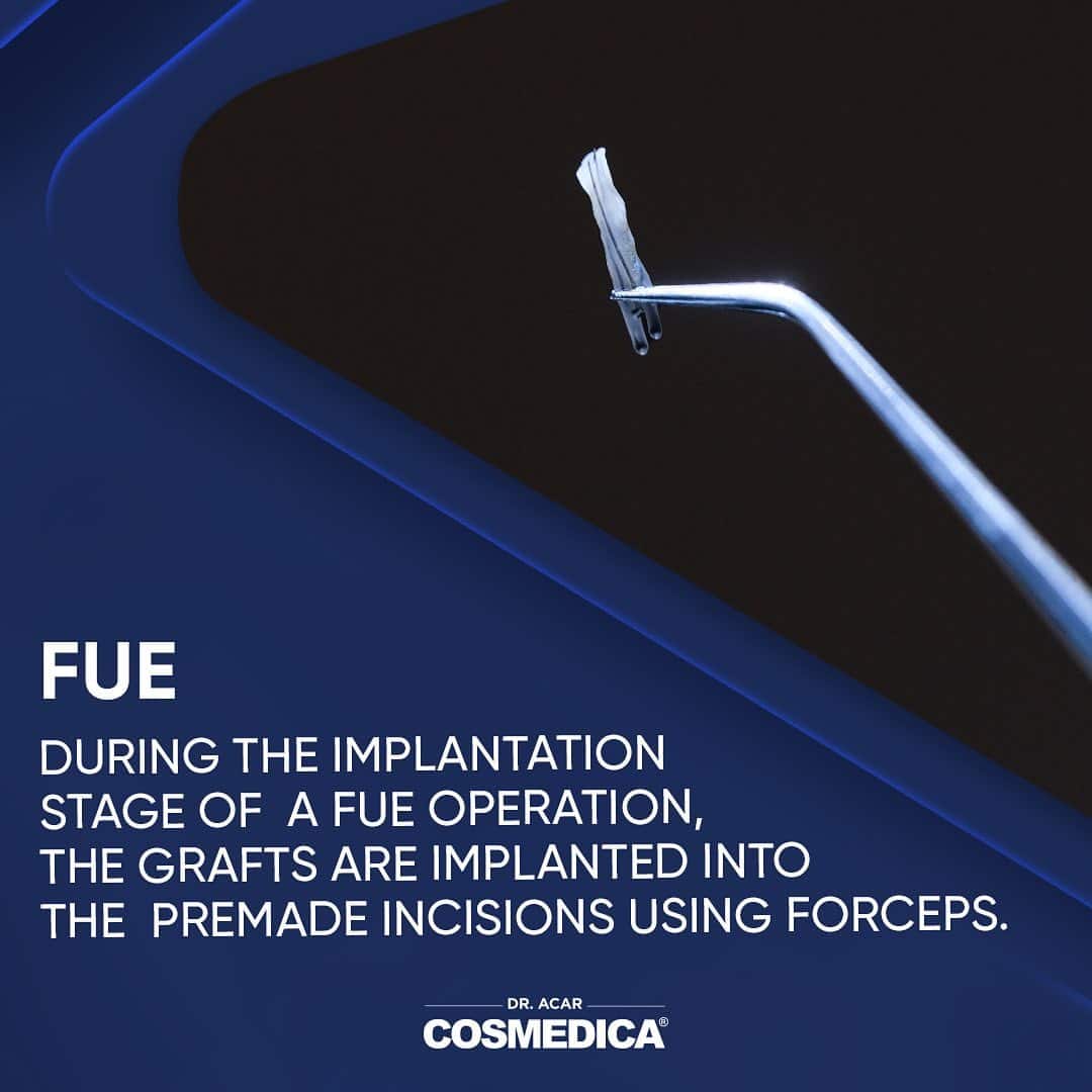 FUE hair transplant - Cosmedica Clinic | Dr. Levent Acar