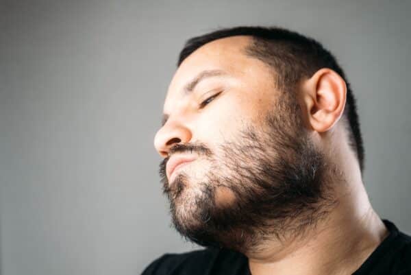 Dealing with Alopecia Barbae: Tips for Your Beard Hair Loss