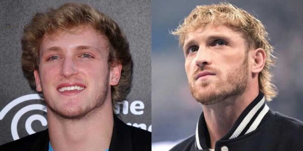 Logan Paul Hair Transplant. Did It Really Happen? - Cosmedica Clinic